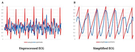 Ecg Samples And The Synthetic Ecg In The Unprocessed State A And The Download Scientific