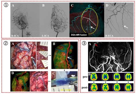 A Representative Case Performed The Flow Controlled Sta Mca Download Scientific Diagram