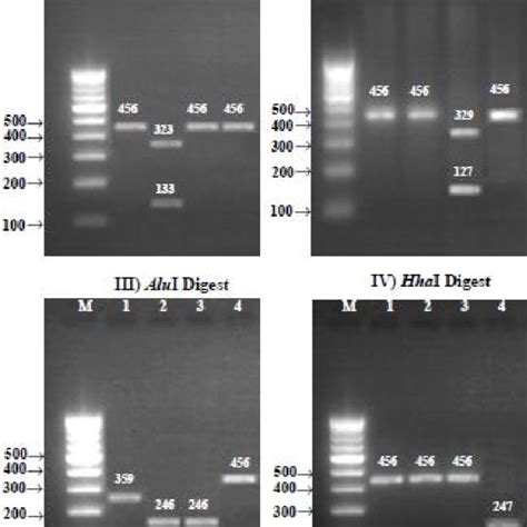 Restriction Fragment Length Polymorphism Rflp Of Mitochondrial 12s Download Scientific