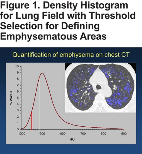 biomarkers and novel imaging in copd journal of copd foundation