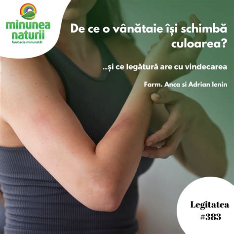 De Ce O Vânătaie își Schimbă Culoarea Legitatea 383 Minuneanaturiiro