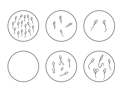 Illustration Of Sperm Pathologies Spermogram Sperm Defects Defects
