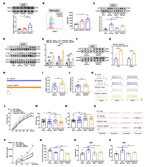 If 19 227【客户文章】徐州医科大学张咏梅教授团队揭示前扣带皮层参与结肠炎后内脏超敏反应和抑郁样行为神经免疫调控的机制 知乎