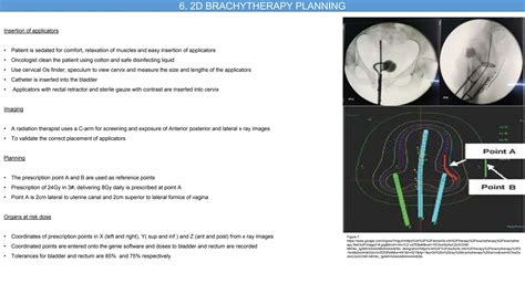 Brachytherapy Pptx