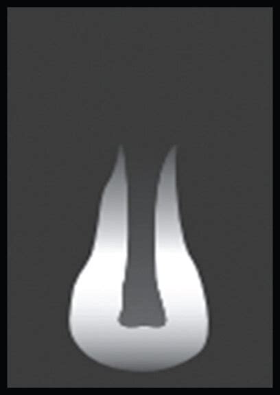 Root Development Stages A B C D And E Represent Stages