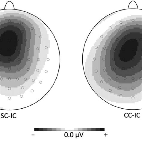 The Scalp Topography For The Sc Ic Difference Left And The Scalp Download Scientific Diagram