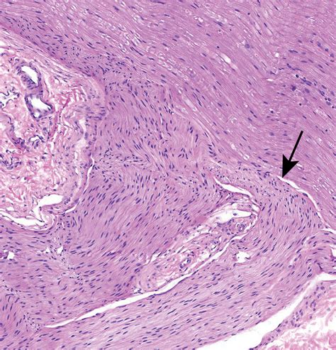 Atlas Of Normal Microanatomy Procedural And Processing Artifacts