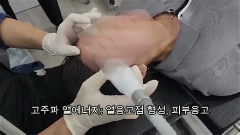 시크릿 레이저 청담제이더마의원 Youtube