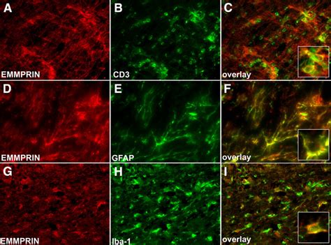 Emmprin Is Expressed By Both Cns Resident And Infiltrating Cells In