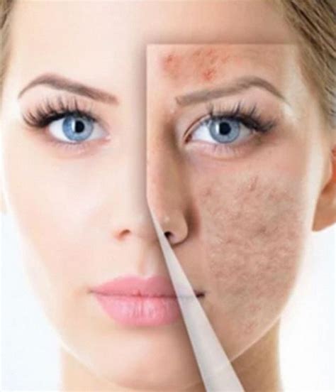CLINIQUE MÉDICO ESTHÉTIQUE COMPLEXIONS Medico Aesthetic Clinic Laval Advanced Aesthetics