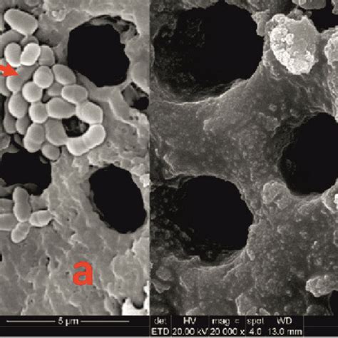 Scanning Electron Microscopy Of Enterococcus Faecalis 21 Day Old Download Scientific Diagram