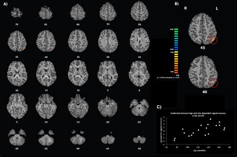 Figure 4 From Developmental Specialization Of The Left Parietal Cortex For The Semantic