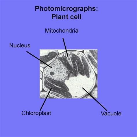 What Do Plant Cell Structures Look Like Under A Microscope Ioteach