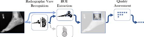 Figure 1 From An Ai Based Framework For Diagnostic Quality Assessment Of Ankle Radiographs