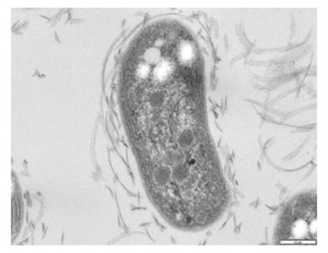 Difference Between Nitrosomonas And Nitrobacter Compare The