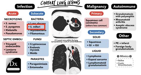 Some Pearls From Yaleimchiefss Riveting Strep Intermedius Case 🧵 Thread From Andrew