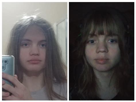 9 Months On Hrt Started At 17 Am Now 18 Rtranstimelines