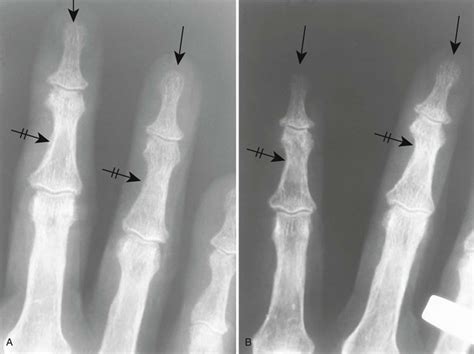 Extremity Patterns Radiology Key