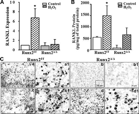 Smooth Muscle Cellspecific Runx2 Deficiency Inhibits Vascular