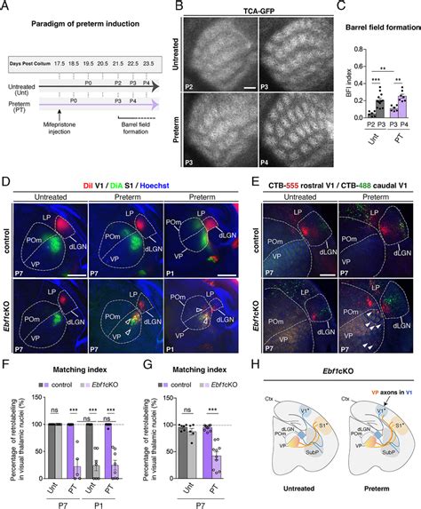 Preterm Birth Affects The Efficiency Of TCA Rewiring A Experimental Download Scientific
