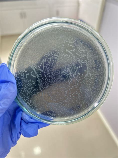 Buffered Charcoal Yeast Extract Agar Base Selective Isolation And Cultivation Of Legionella