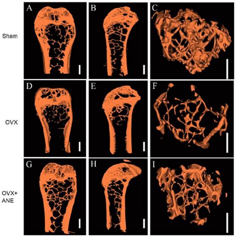 Three‑dimensional Micro‑computed Tomography Images 8 Mm Resolution Of Download Scientific