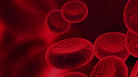 Polycythemia Vera Hemoglobin Levels Polycythemia Vera Presenting With