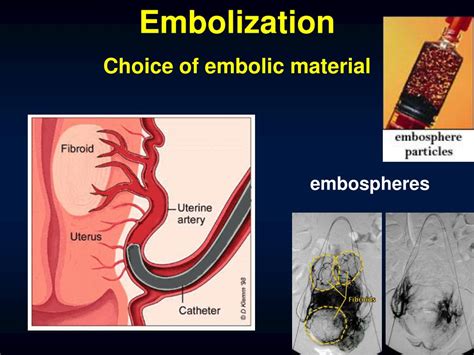 Ppt Lower Gastrointestinal Bleeding Powerpoint Presentation Free
