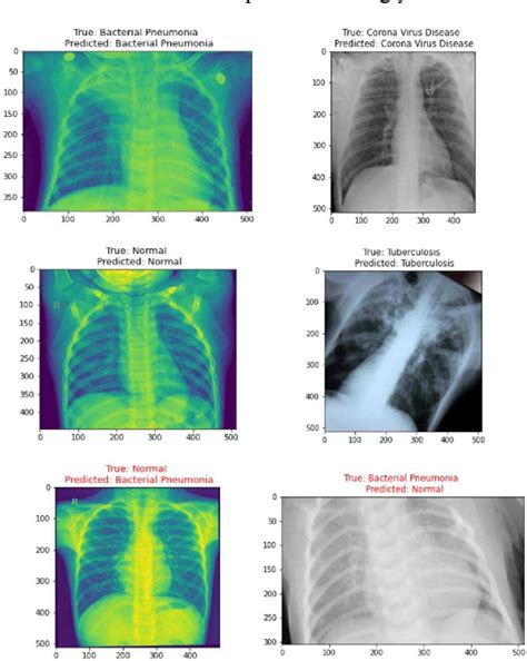 Figure 1 From Chest X Ray Image Analysis For Respiratory Disease Prediction Using Grad Cam