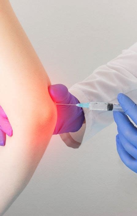 Cervical Epidural Steroid Injection Near Ankeny Ia Central States
