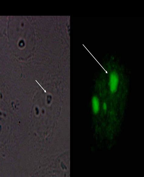 Indirect Immunofluorescence Iif Showed Diffuse Fluorescence Of The