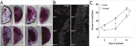 Scaffold Cellularization By Perfusion Bioreactor Based Seeding A