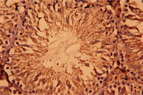 Testicular Expression Of Proliferating Cell Nuclear Antigen Pcna