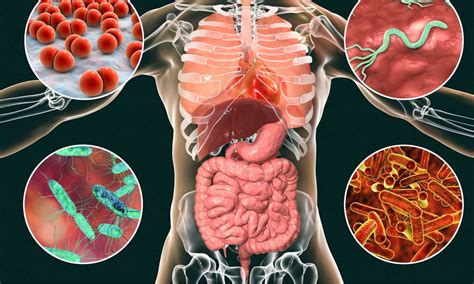 Fda Approves First Pill For Faecal Transplants To Prevent Recurrent Clostridioides Difficile