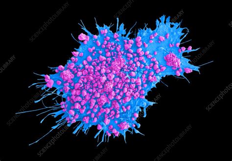 Cervical Cancer Cell Sem Stock Image C Science Photo Library