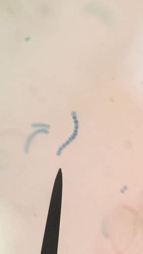 Prokaryote Lab Quiz Flashcards Quizlet