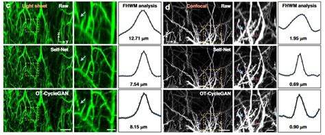 Deep Self Learning Enables Fast High Fidelity Isotropic Resolution Restoration For Volumetric