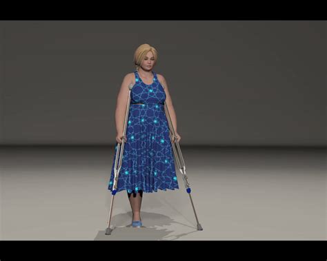 Fatty Anabelle Amputee By Oldsiodier On Deviantart