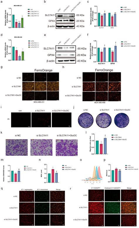Gluoc Induced Slc7a11 And Slc38a1 To Activate Redox Processes And