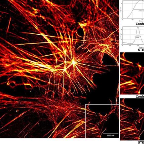 Scheme Of The Expansion Microscopy Technique As Originally Described By Download Scientific