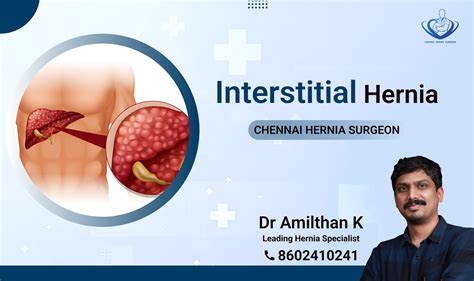 Interstitial Hernia Chennaiherniasurgeon