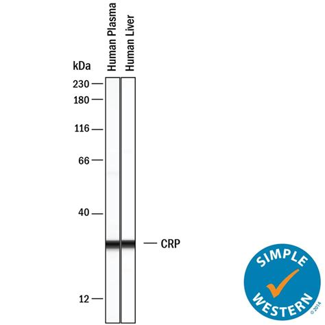 Detection Of Human C‑reactive Proteincrp By Simple Westerntm
