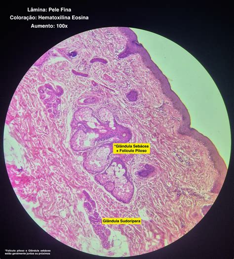 Histologia De Tecido Conjuntivo Denso Irregular
