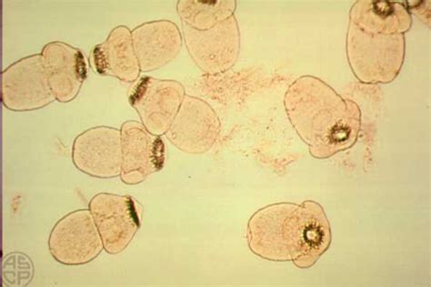 Echinococcus Junglekeyfr Image 150