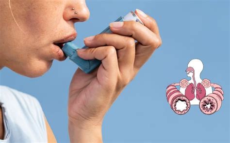 Causes Of Asthma Archives Primus Supe Specialty Hospital In Delhi