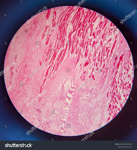 Photo Adipose Tissue Under Microscope Stock Photo Shutterstock