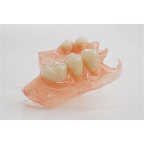 Valplast Partial Upper Roe Dental Laboratory