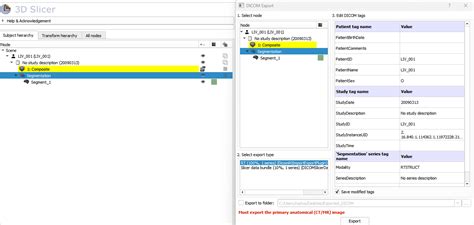 exporting segmentation as dcm support 3d slicer community