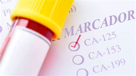 Ca125 ¿marcador De Mortalidad En Insuficiencia Cardiaca Descompensada