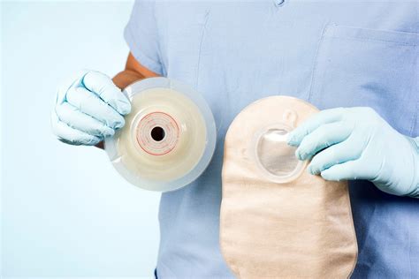 Caring For Your Ostomy Shop Ostomy Supplies